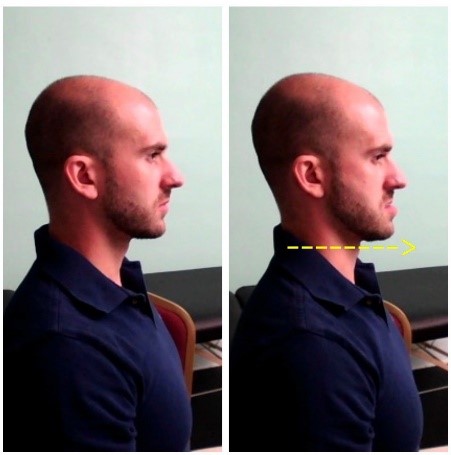 Exercises for Temporomandibular Disorder - Sheltering Arms Institute